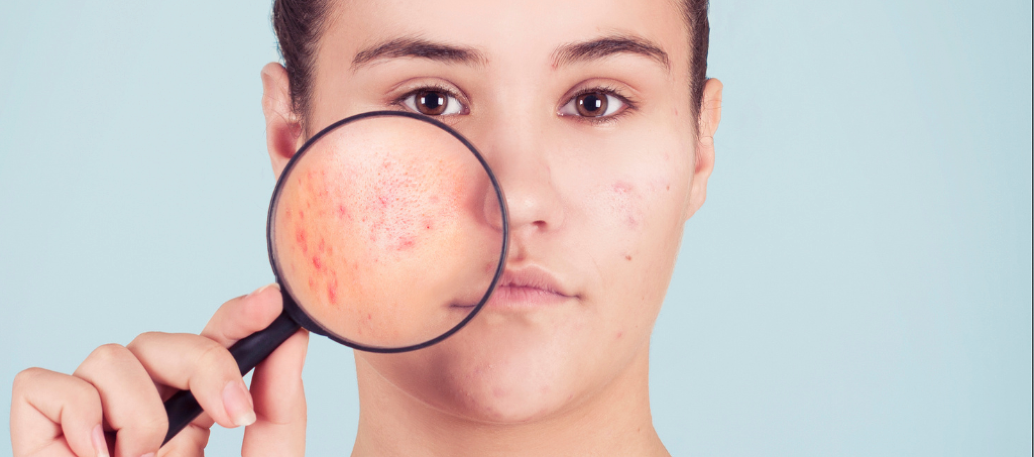 Zit Stik Q&As – Necessity Natural Skin Care